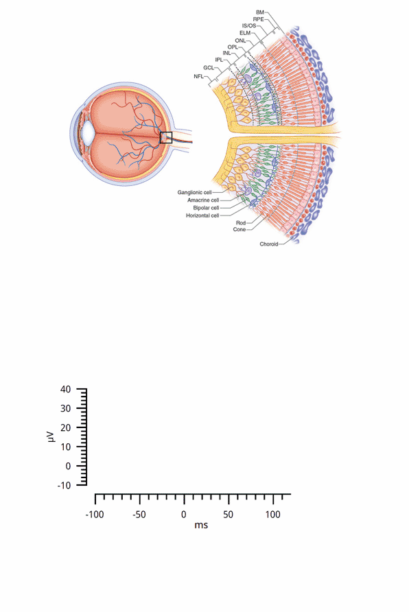 Electroretinography (ERG) Explained | LKC Technologies