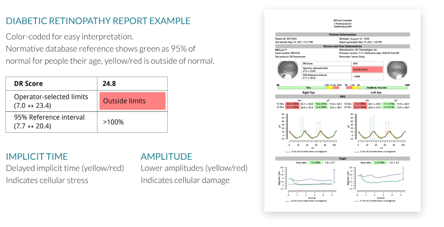 The Ultimate Guide to Diabetic Retinopathy in Primary Eyecare