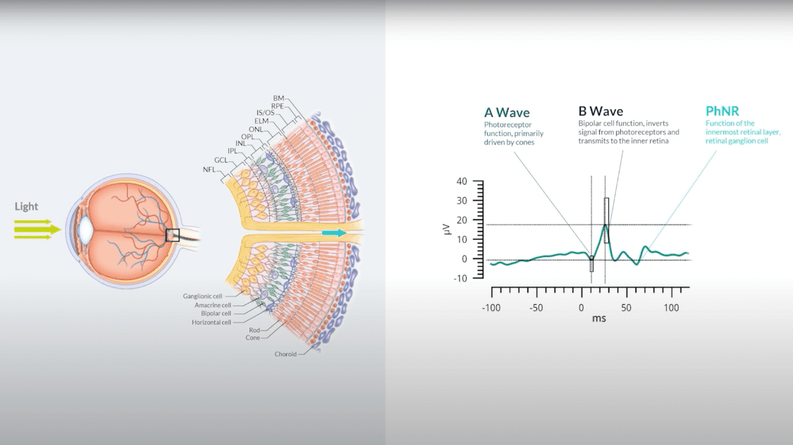 Electroretinography (ERG) - LKC Technologies