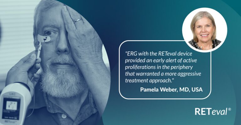 ERG's Role in Diabetic Retinopathy Progression Monitoring