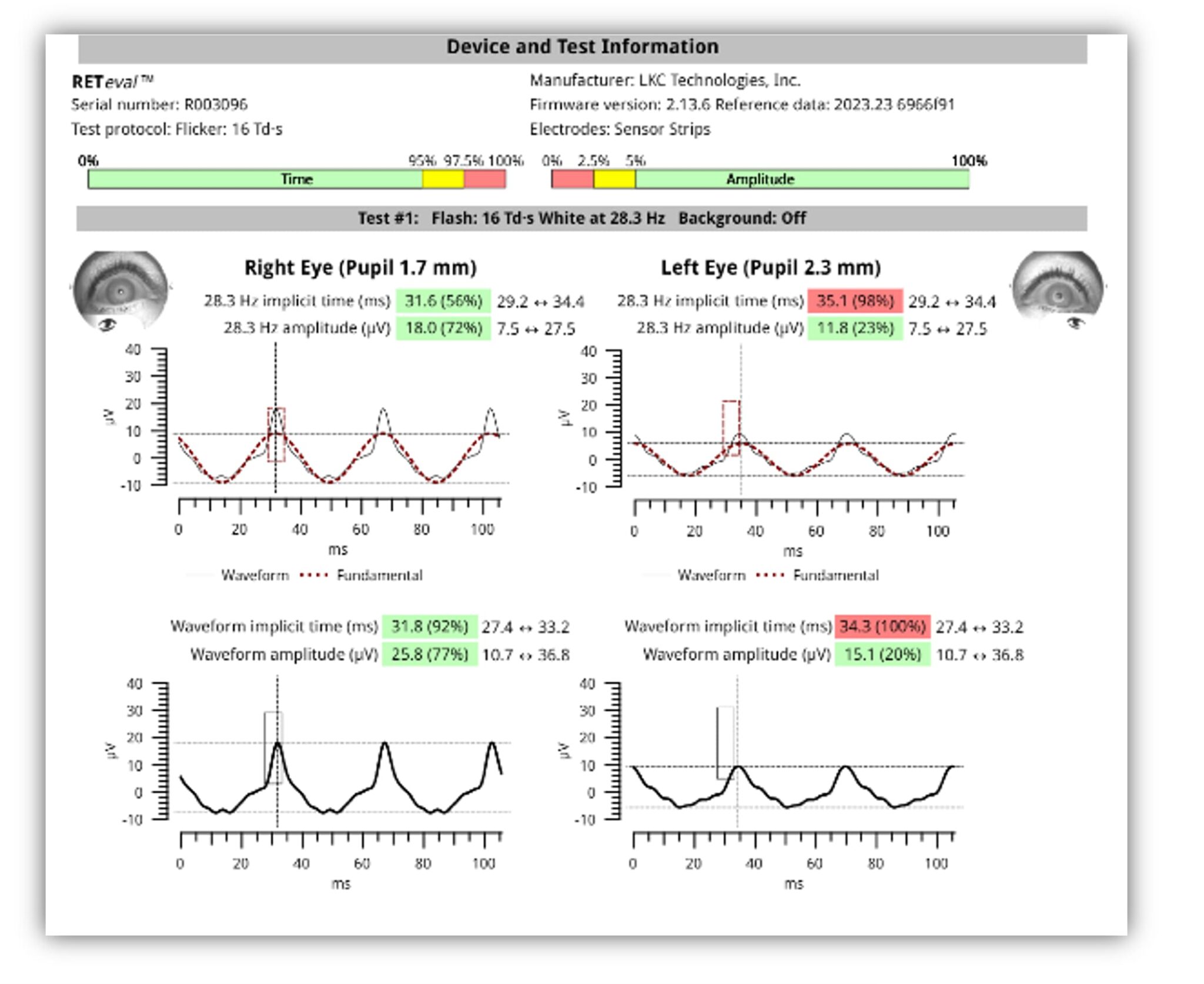 Routine ERG Use Supports Complex Patient Management - LKC Technologies