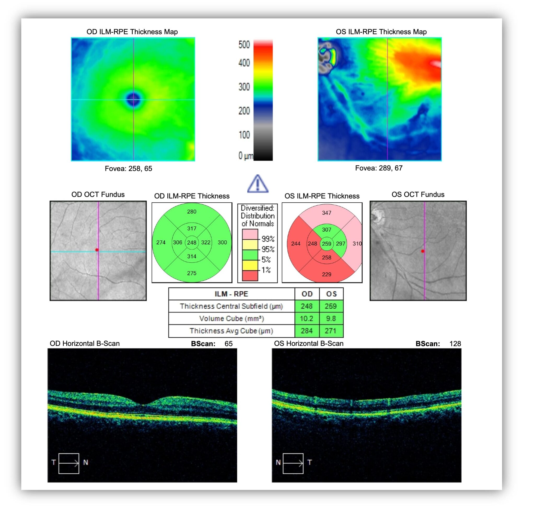 Routine ERG Use Supports Complex Patient Management - LKC Technologies