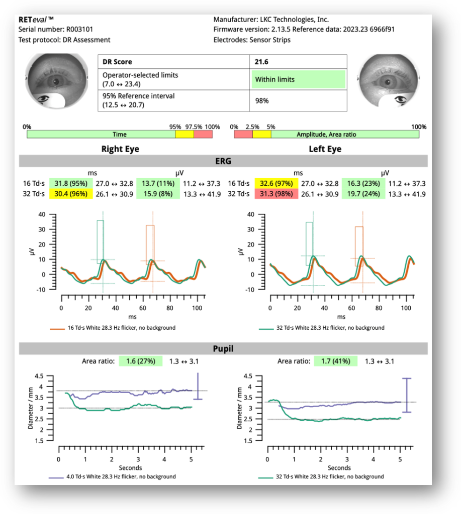 Vision Complaints Reflected on ERG